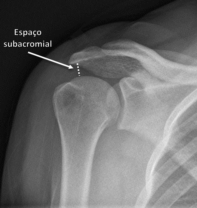 Medidas Ortopédicas - Radiologia Online