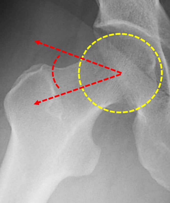 Medidas Ortopédicas - Radiologia Online