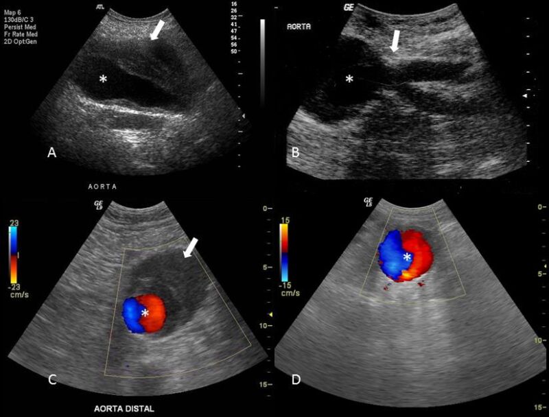 Manual de Doppler - Radiologia Online
