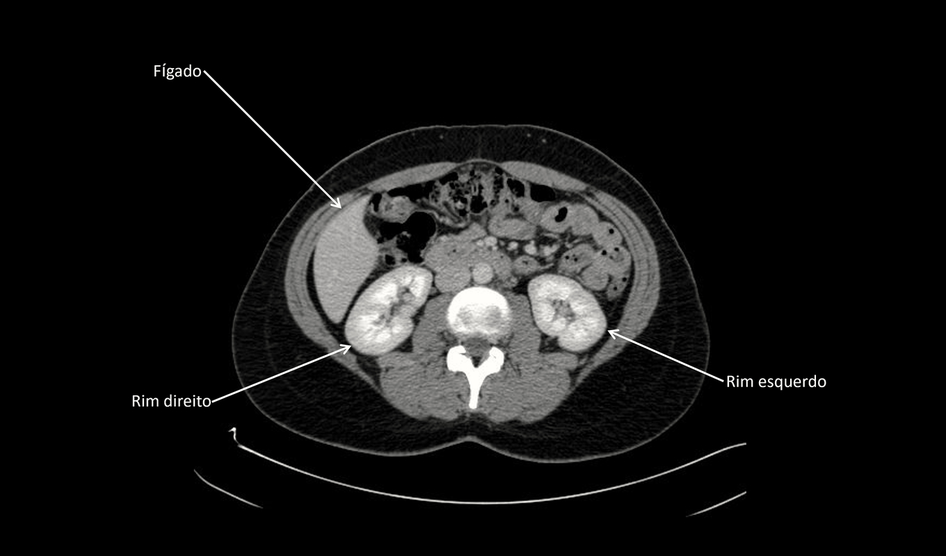 Anatomia: TC de ABDOME